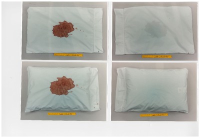 "Test pillow 03" by Cuyahoga County Coroner's Office and James Wentzel